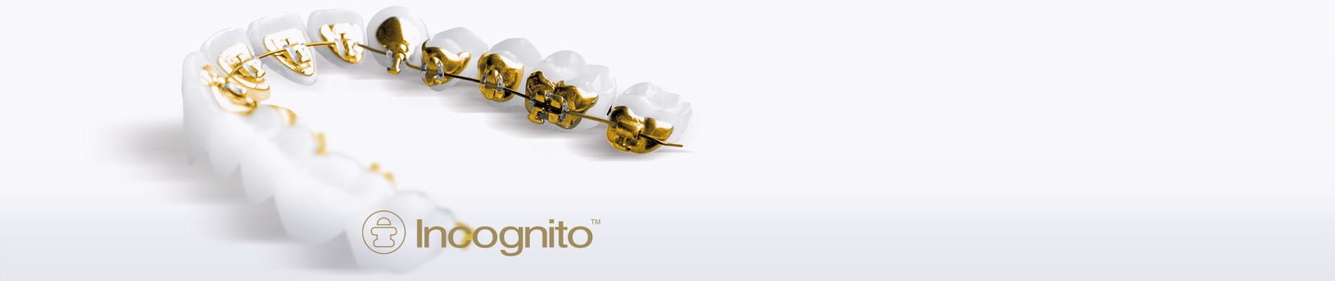 Incognito Braces | Dentalcare Langley Orthodontics | Hidden Braces